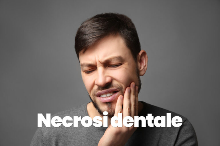 Necrosi dentale: cos'è, cause e cure | Cosa fare quando un dente è morto